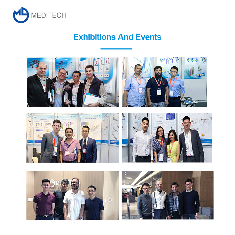 Posterior Cervical Screw System - CZMEDITECH